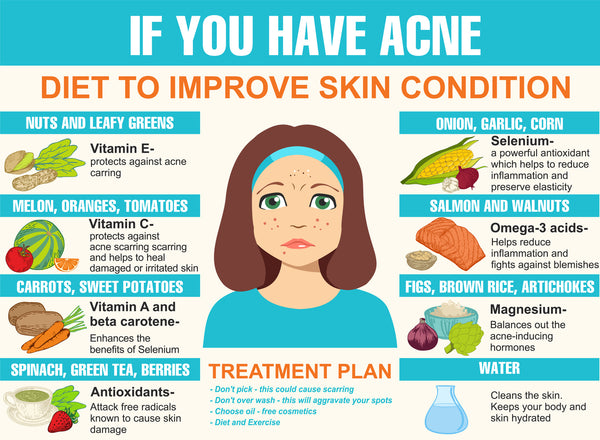 Here Are 14 Foods That Can Help Reduce The Risk Of Acne