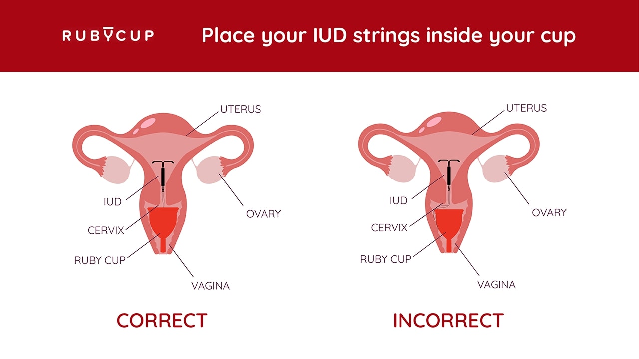 Menstrual Disc Vs Cup Which Is Better Medically Reviewed Ruby Cup