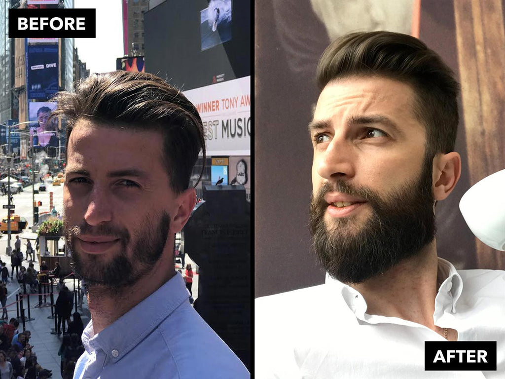 How To Fix Your Patchy Beard Beardbrand