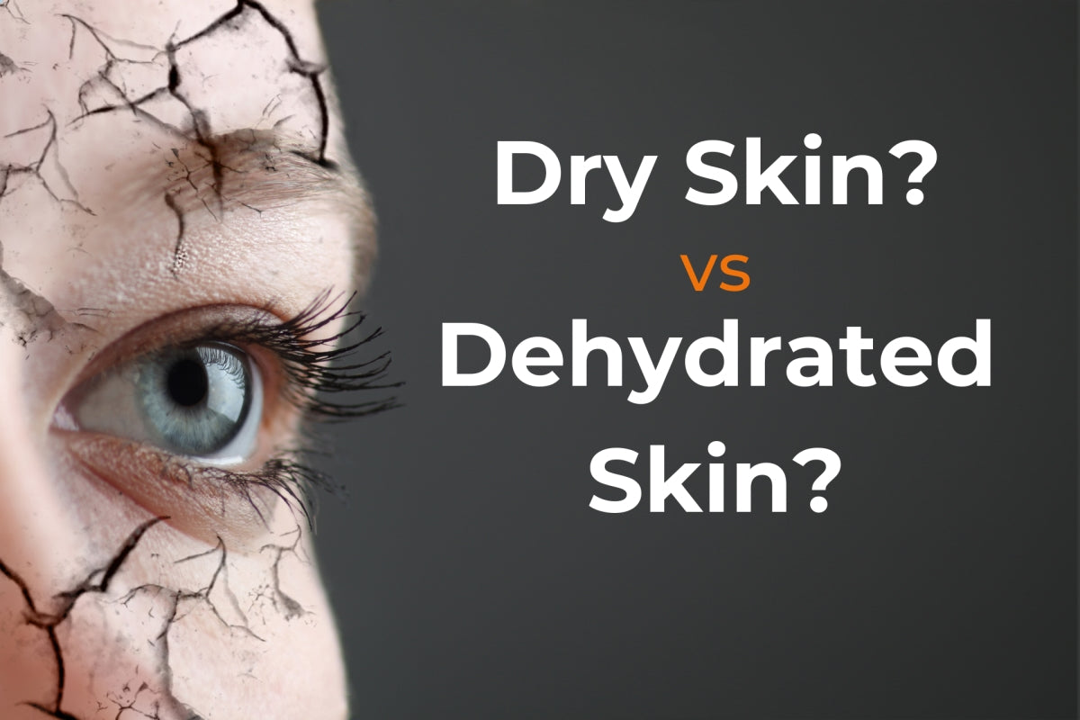 Dehydrated Skin Vs Dry Skin Whats The Difference And Why It Matters For