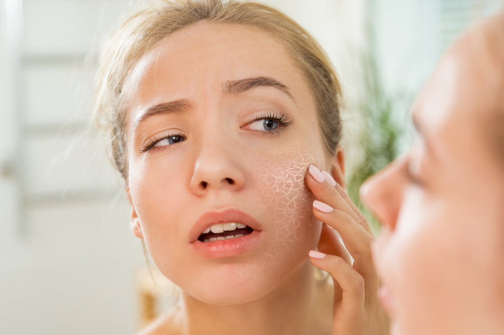 How To Keep Skin Hydrated 17 Tips To Prevent And Treat Dry Skin