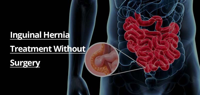 Hernia Diagram Of Inside Umbilical And Inguinal Hernia Men With Hernia