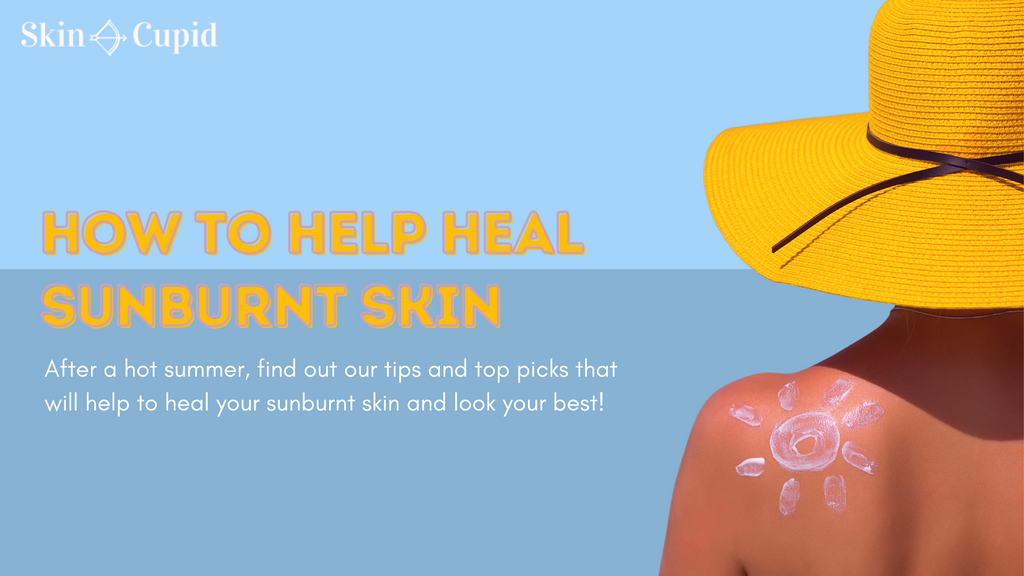 How To Help Heal Sunburnt Skin Skin Cupid