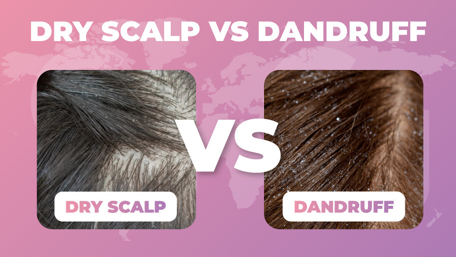 Differences Between Dandruff And Dry Scalp Explained