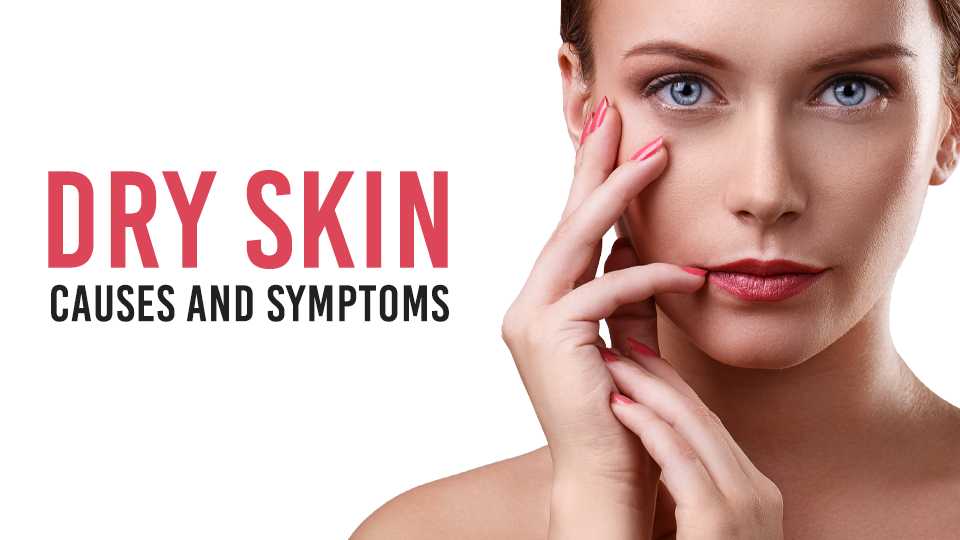 Dry Skin Causes And Symptoms Vince Care