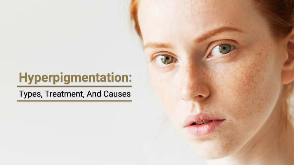 Hyperpigmentation Types Treatment And Causes