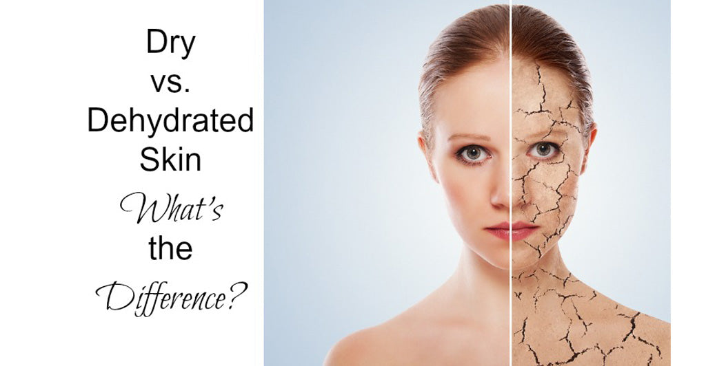 Dry Skin Vs Dehydrated Skin