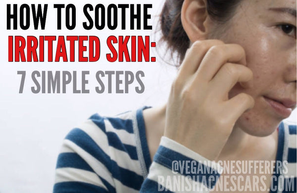 How To Soothe Irritated Skin 7 Simple Steps