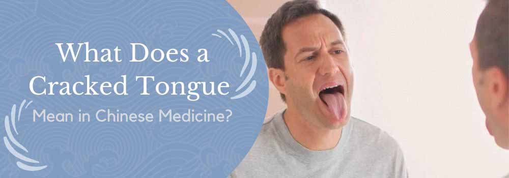 Understanding Your Health With Tcm Tongue Diagnosis Ohco