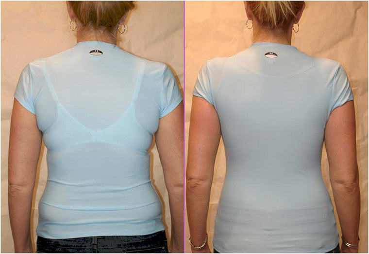 Real Life Transformations In Our No Back Fat Bra Before And After