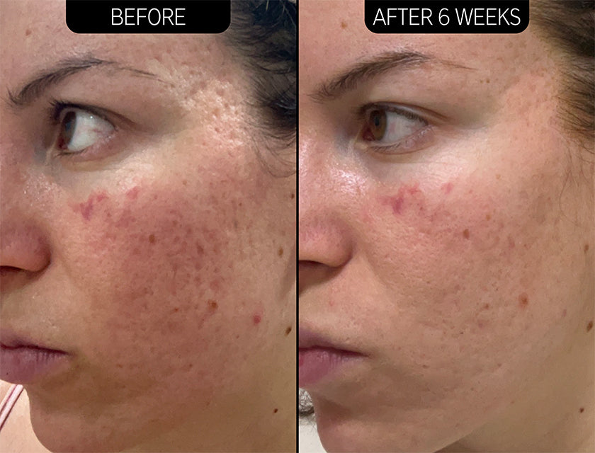 Scar Mark And Wrinkle Solution With 1 Retinol Serum The Inkey List