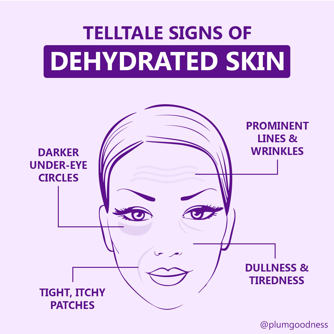 Dehydrated Skin