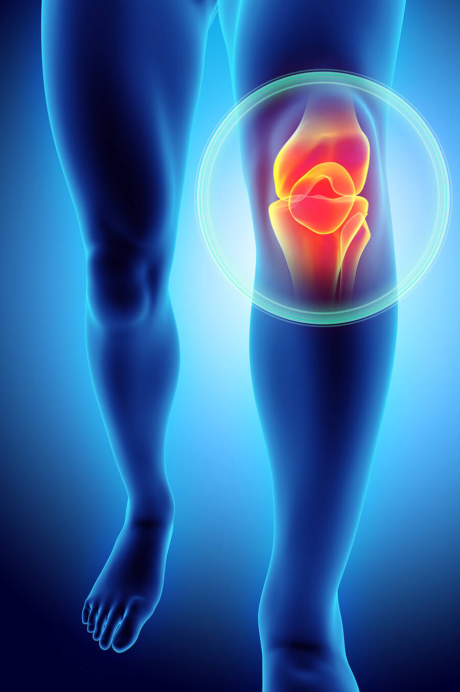 Knee Pain And Sore Knees Causes Symptoms And Treatments Synxsole