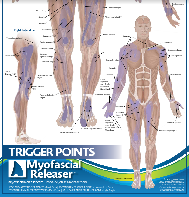 Trigger Point Anatomy Map Poster Sized Myofascial Releaser