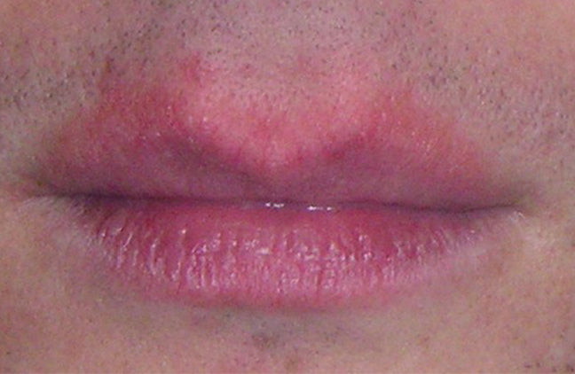 Lip Authority Seaside Medical Technologies