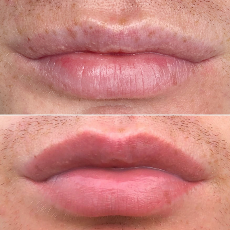 Case Study Mens Lip Blushing Tina Davies Professional