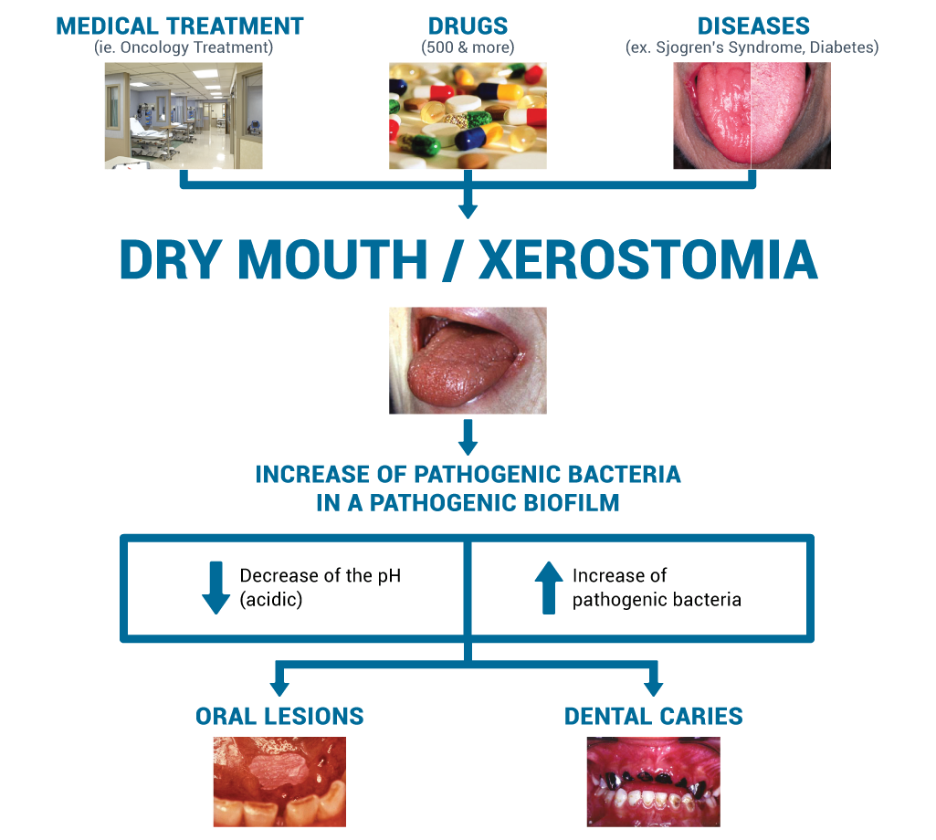 Elizabeth Locker Dry Mouth Symptoms Causes And Treatment