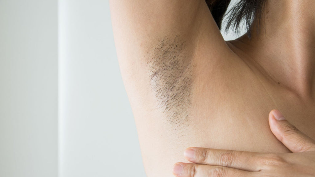 Armpit Rashes Causes Symptoms And How To Treat Them 58 Off