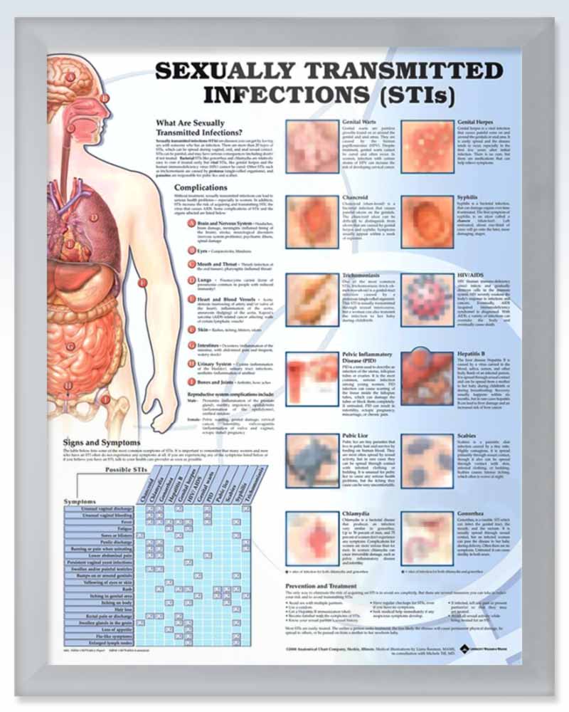 Sexually Transmitted Infections Anatomy Posters Clinicalposters