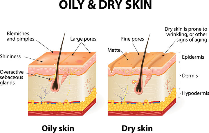 Oily Skin Causes Prevention And Treatments Skinkraft