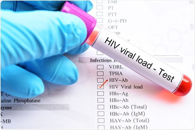 What Is Viral Load