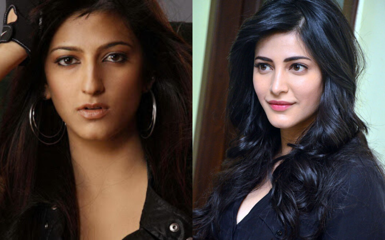 Before And After Pics Actress Shruti Haasan Reveals Her Plastic Surgery