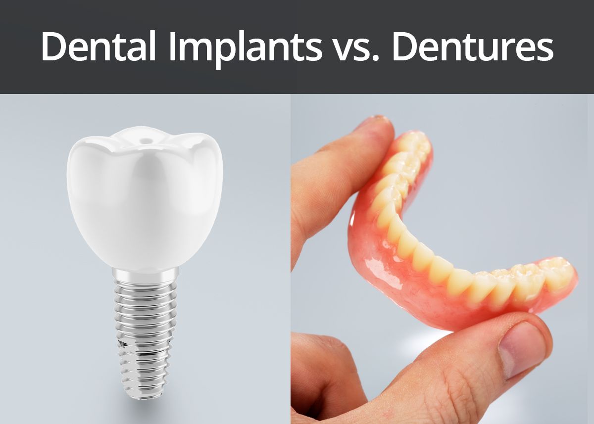 Dental Implants Vs Dentures Boston Ma Boston Prosthodontics