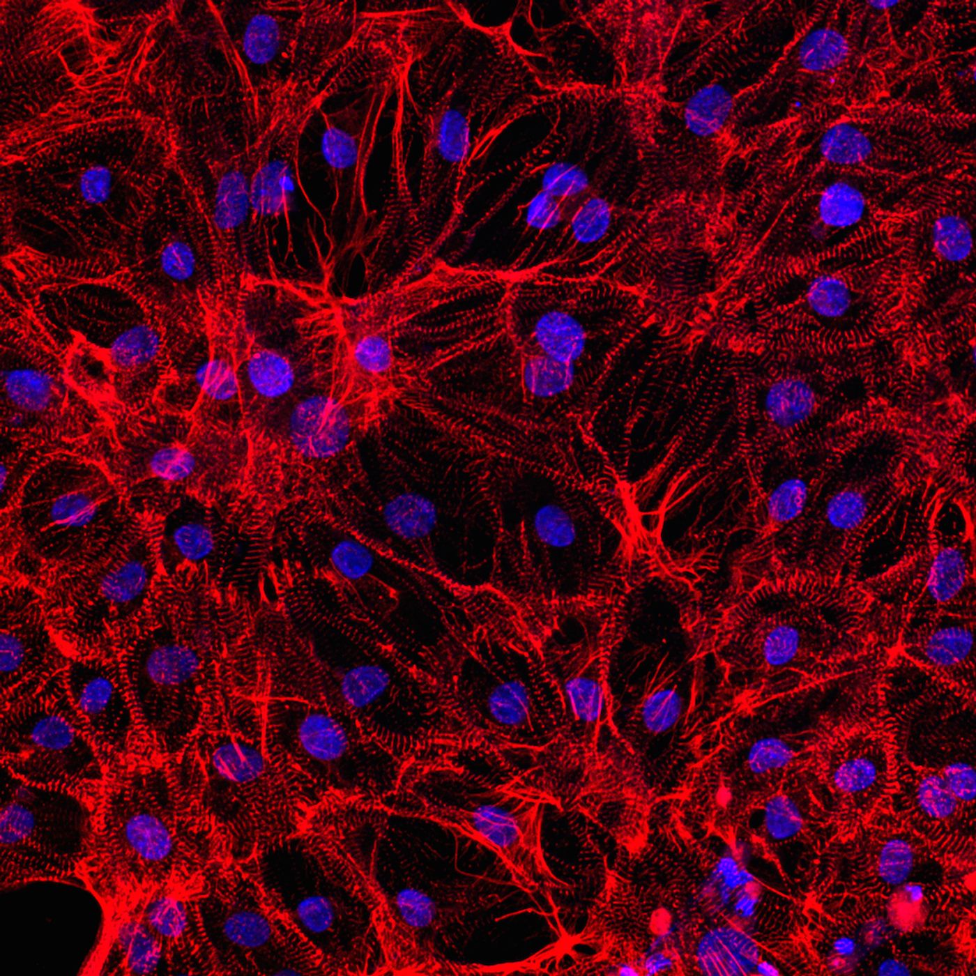 Heart Stem Cells For Individualized Medicine In Cardiology Cardiology