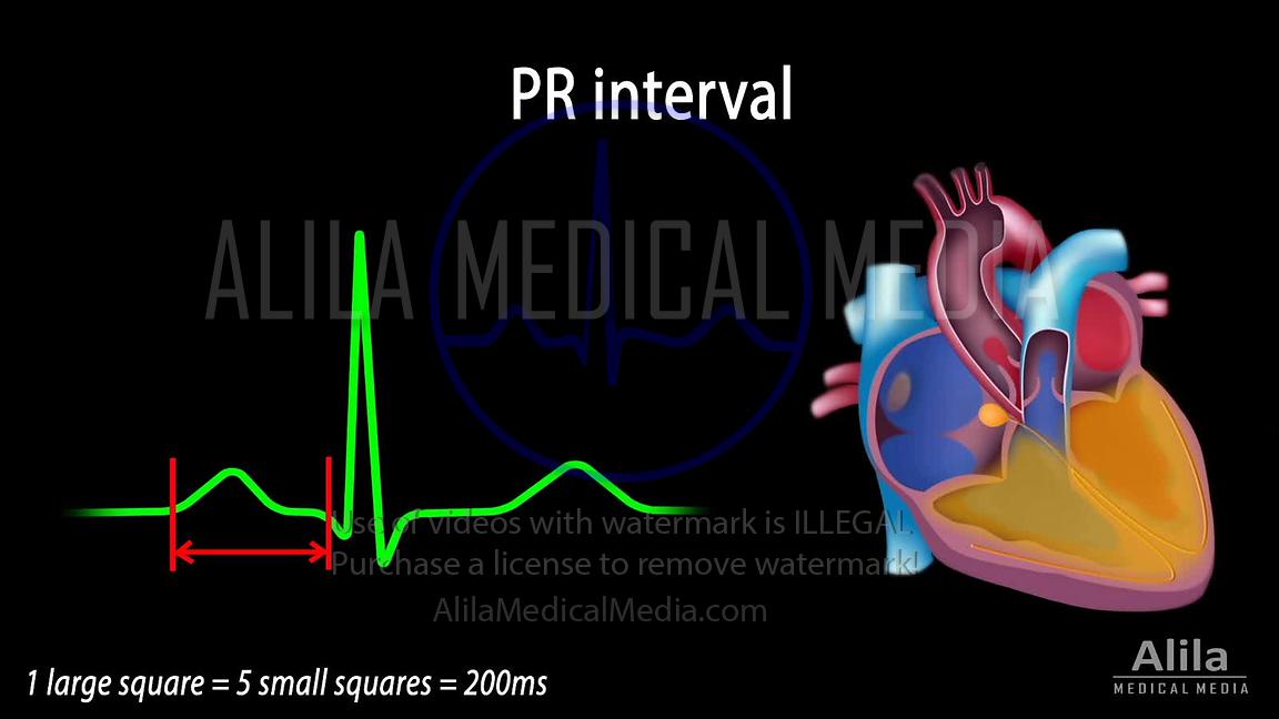 Alila Medical Media Ecg Reading Narrated Animation Part 1 Medical