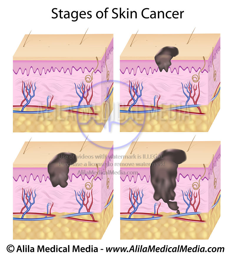 Alila Medical Media Human Skin Anatomy Labeled Diagra