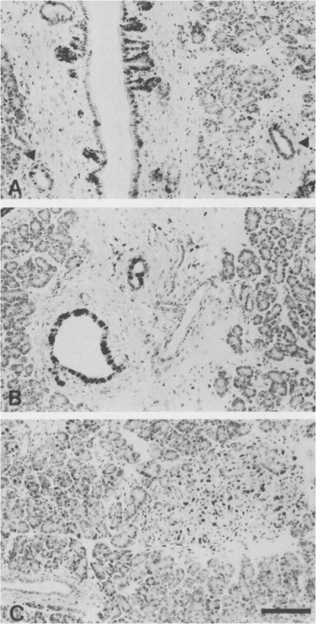 Figure 1 From A Second Pathway For Regeneration Of Adult Exocrine And