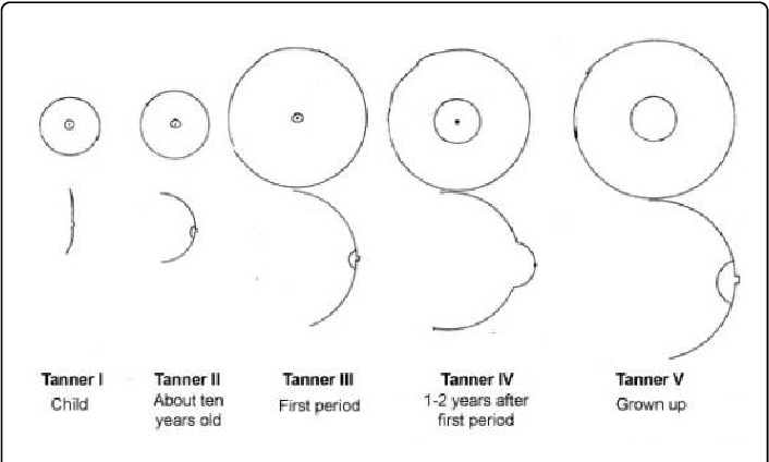 Breast Development Stages Chart