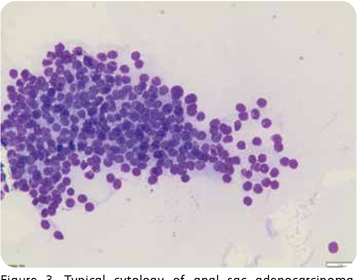 Canine Adenocarcinoma Anal Sac Telegraph