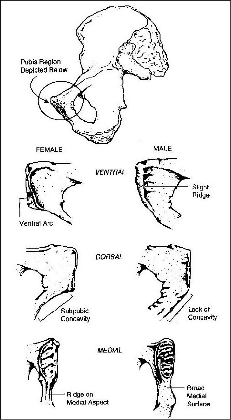 Pdf A Study Of The Accuracy And Reliability Of Sex Estimation Methods