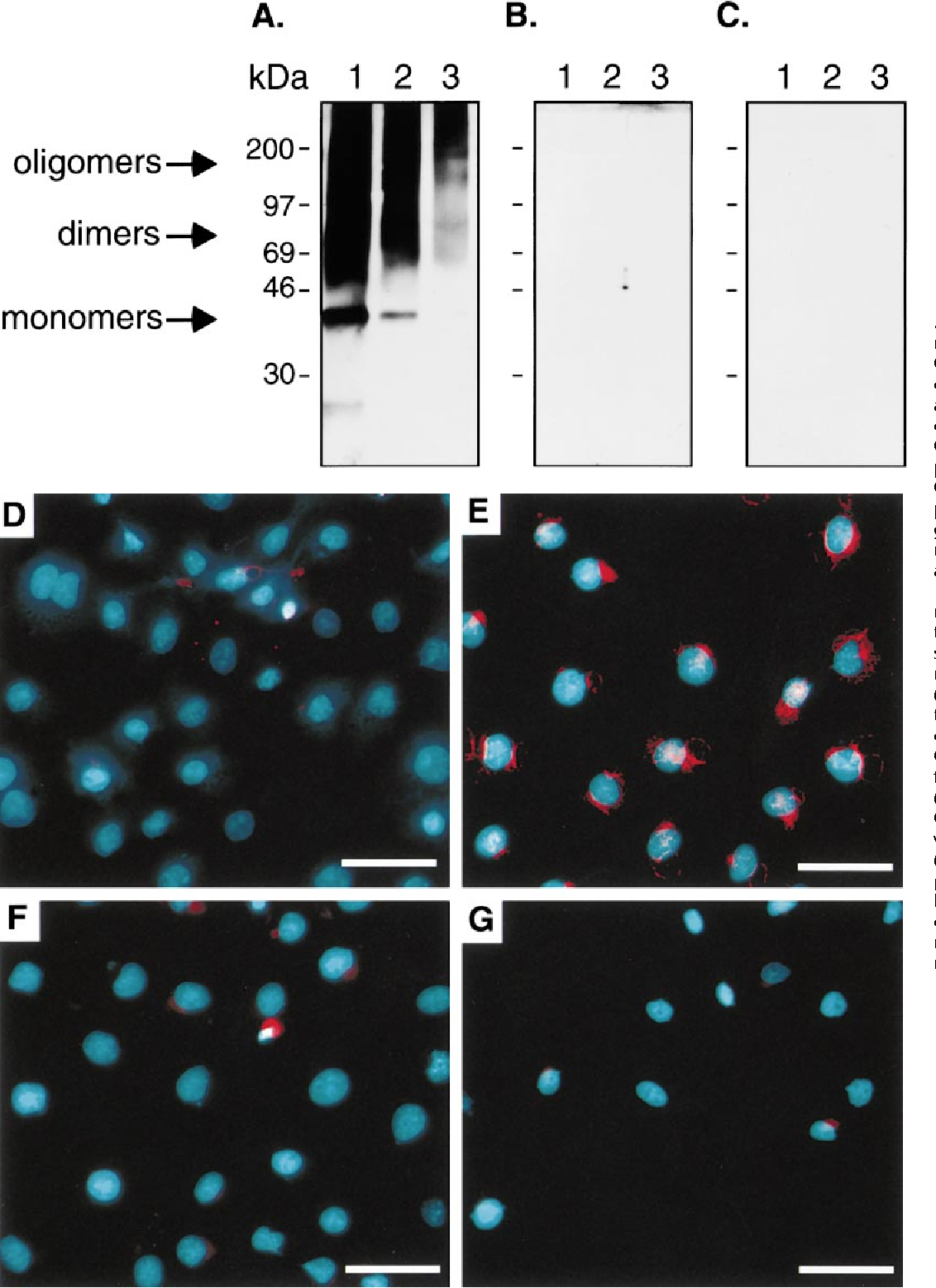 Figure 7 From Expression Of The Cysteinyl Leukotriene 1 Receptor In