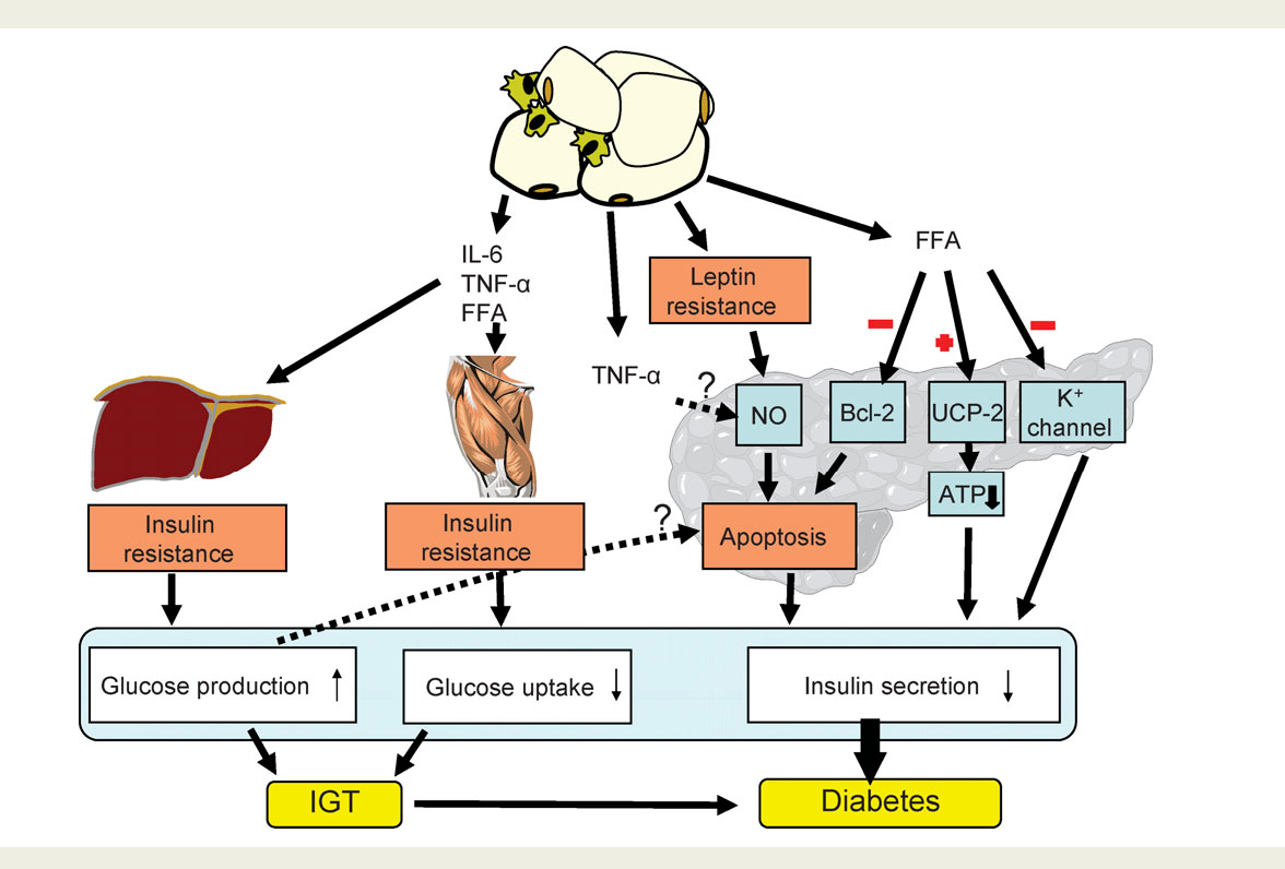 Figure 2 From Adipose Tissue Dysfunction In Obesity Diabetes And