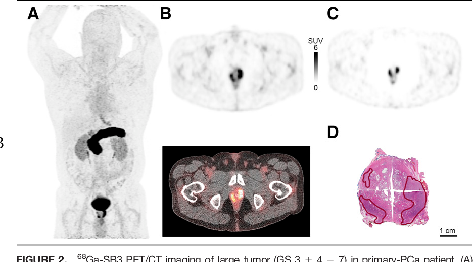 Pdf Grpr Antagonist 68ga Sb3 Petct Imaging Of Primary Prostate