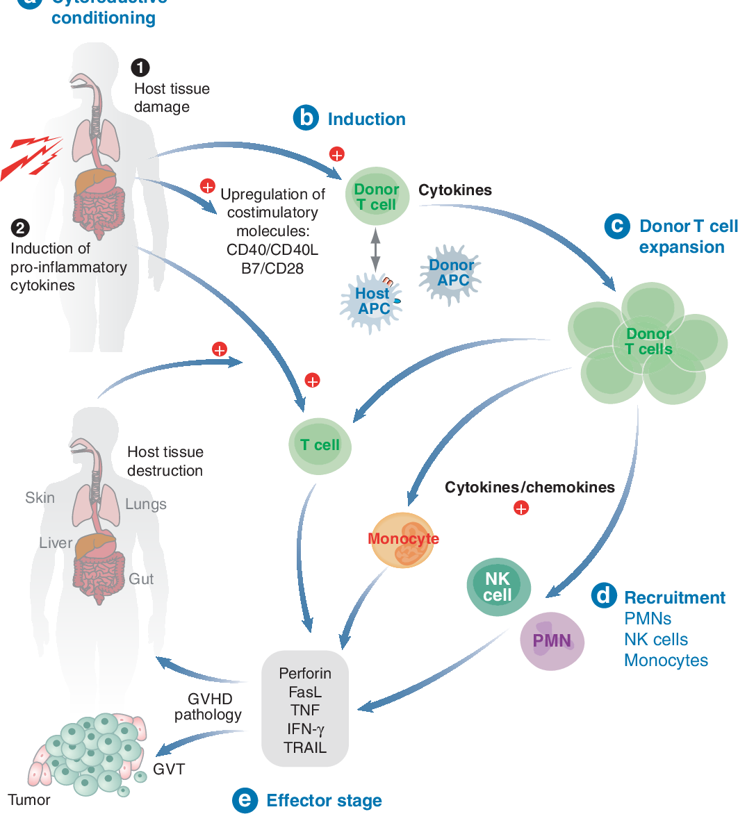 Immunobiology Of Allogeneic Hematopoietic Stem Cell Transplantation