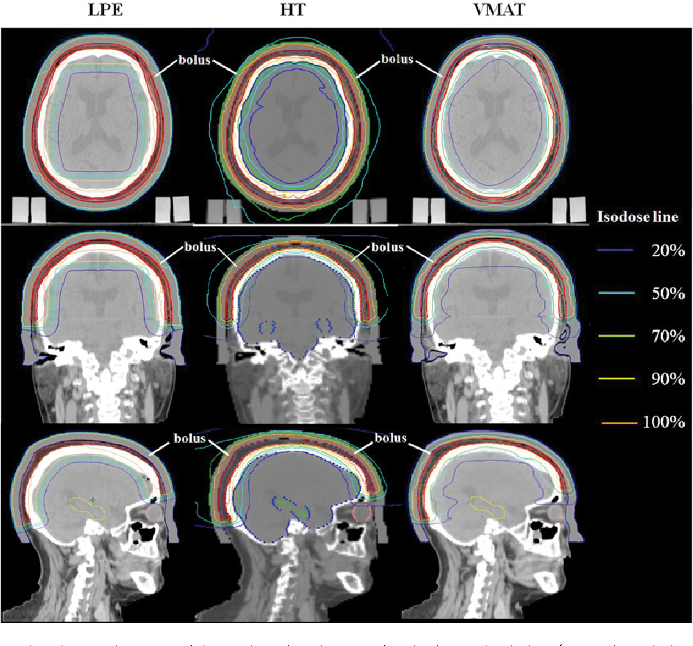 Figure 1 From Dosimetric Comparison Of Three Different Treatment