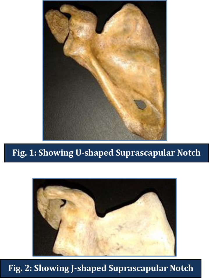 Table 1 From Study Of Anatomical Variations In The Shape Of