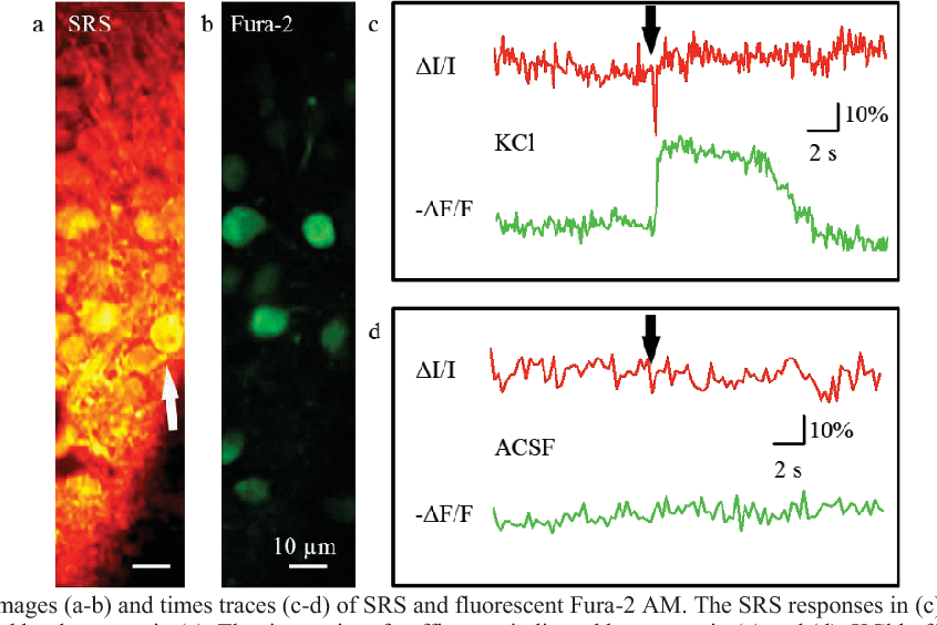 Label Free Imaging Of Single Neuron Activities By Stimulated Raman