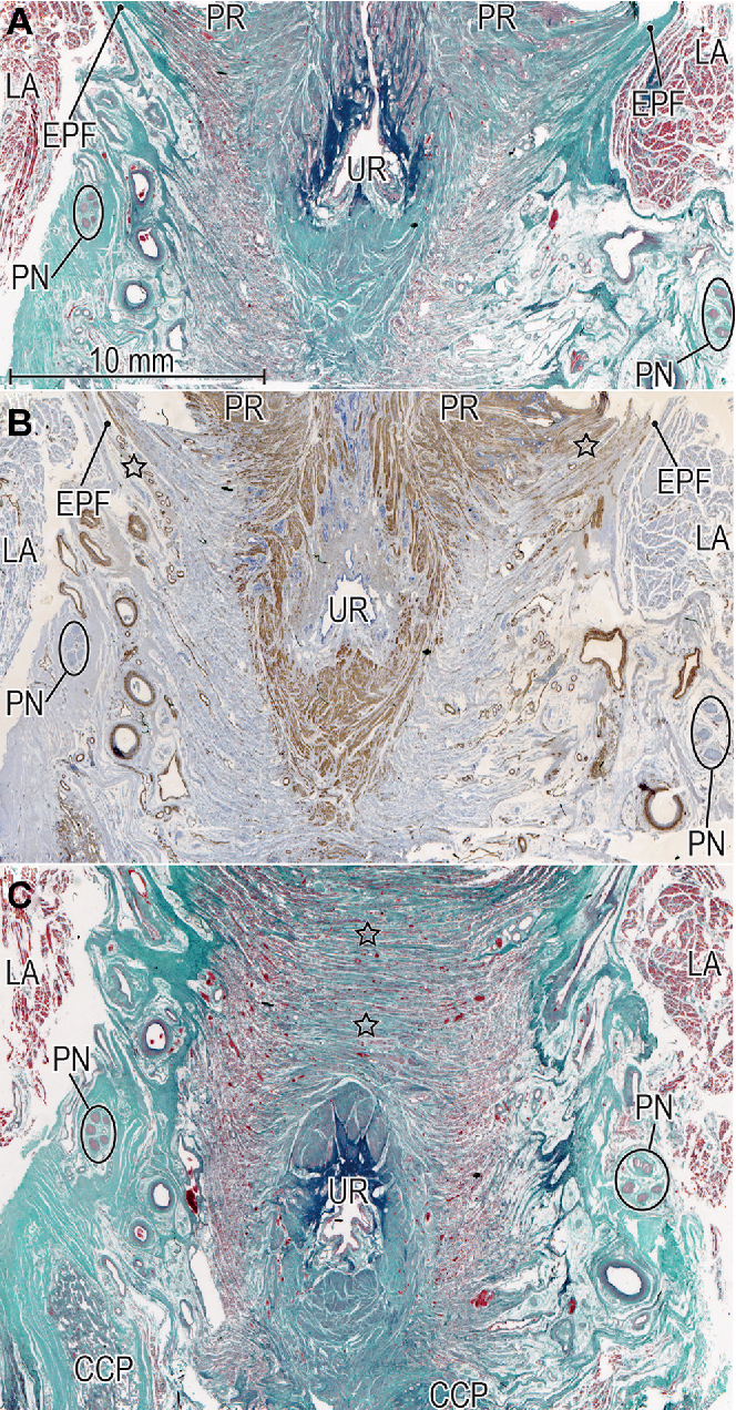 Figure 1 From Histological Study Of The Cavernous Nerve Mesh Outside