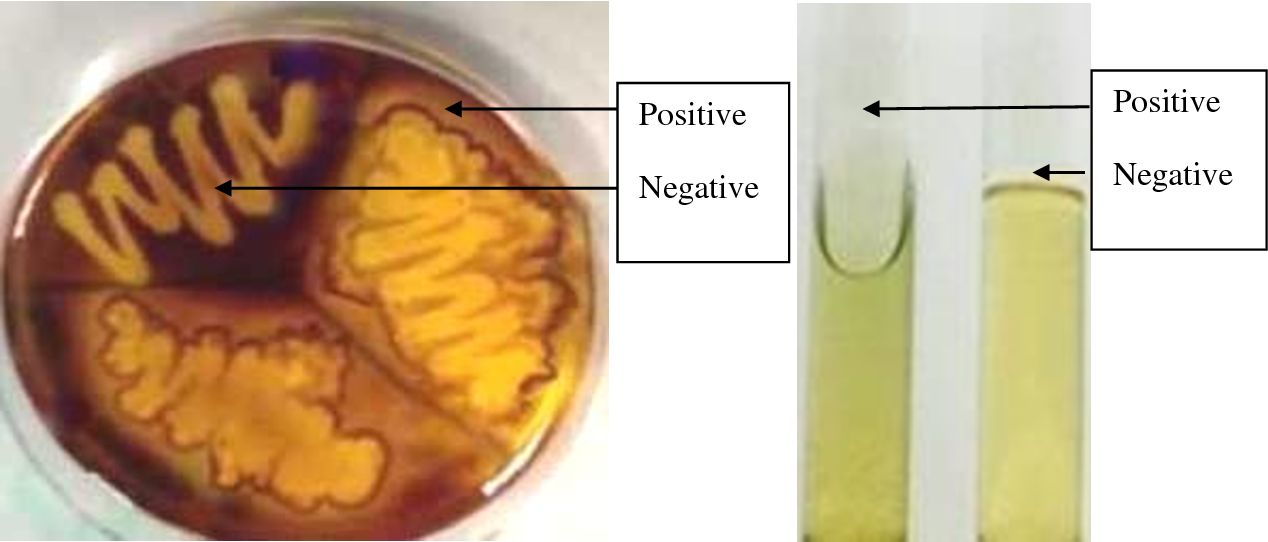 Gelatin Hydrolysis Test