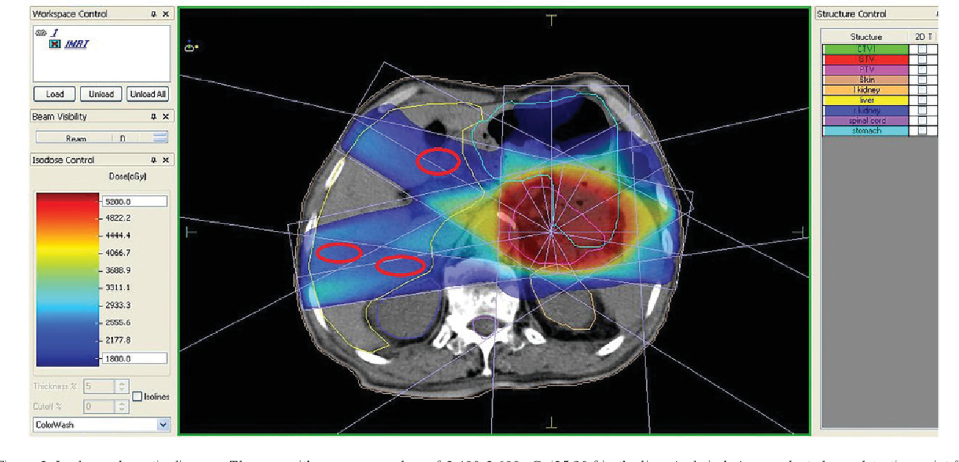 Figure 1 From Application Of Quantitative Analysis Of Contrast Enhanced