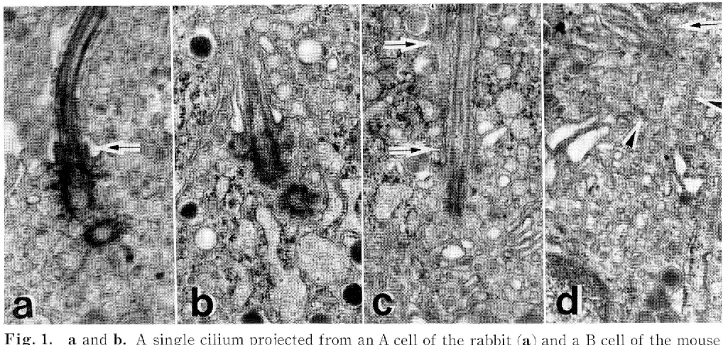 Cilia Electron Microscopes