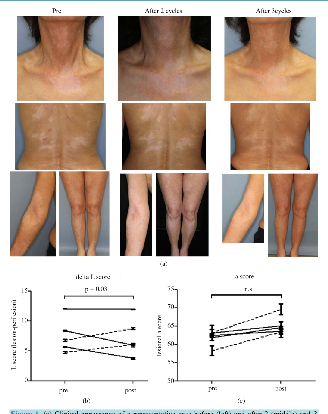 Pdf Preliminary Colorimetric Assessment Of Progressive Nonsegmental