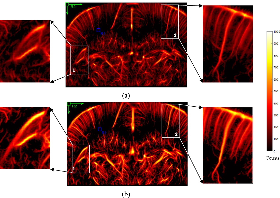 Figure 1 From The Performance Improvement Of Ultrasound Localization