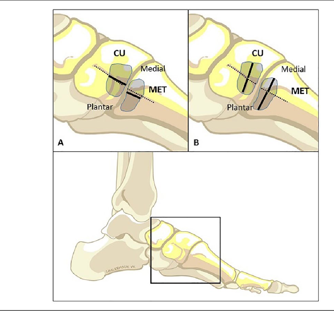 Figure 2 From Appropriate Area For Operative Procedures Near Tibialis