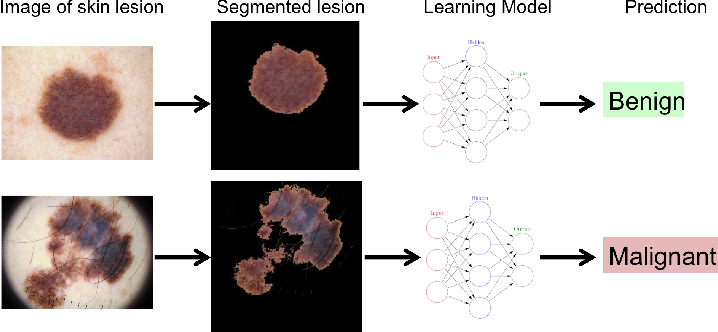 Pdf Vision Based Classification Of Skin Cancer Using Deep Learning