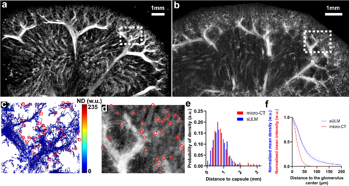 Figure 1 From Sensing Ultrasound Localization Microscopy For The